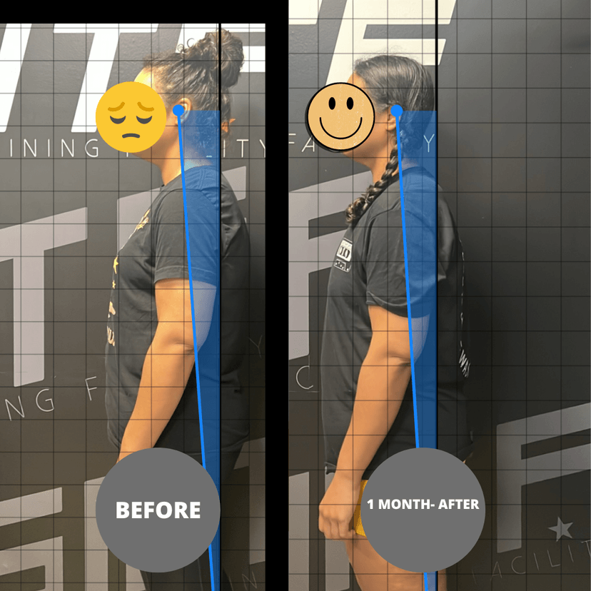 Posture Correction by Miriam Archibald